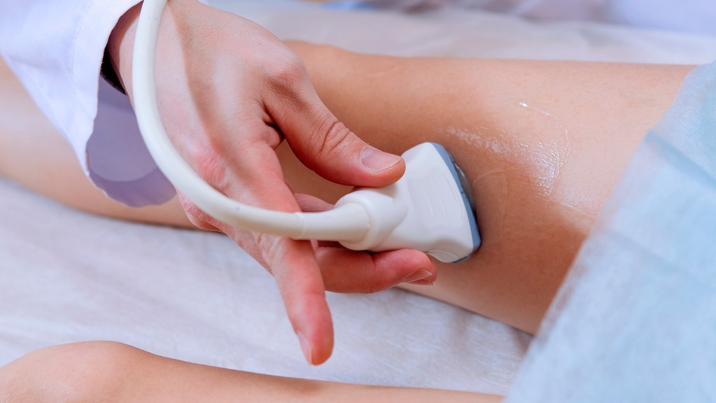 Doppler Venoso Bilateral De Miembros Inferiores Lapi Laboratorio Médico